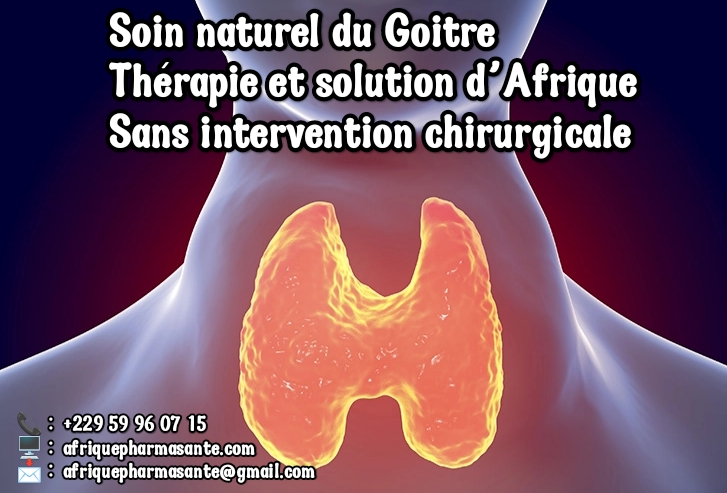 Comment Soigner le Goitre avec les Plantes Médicinales Africaines